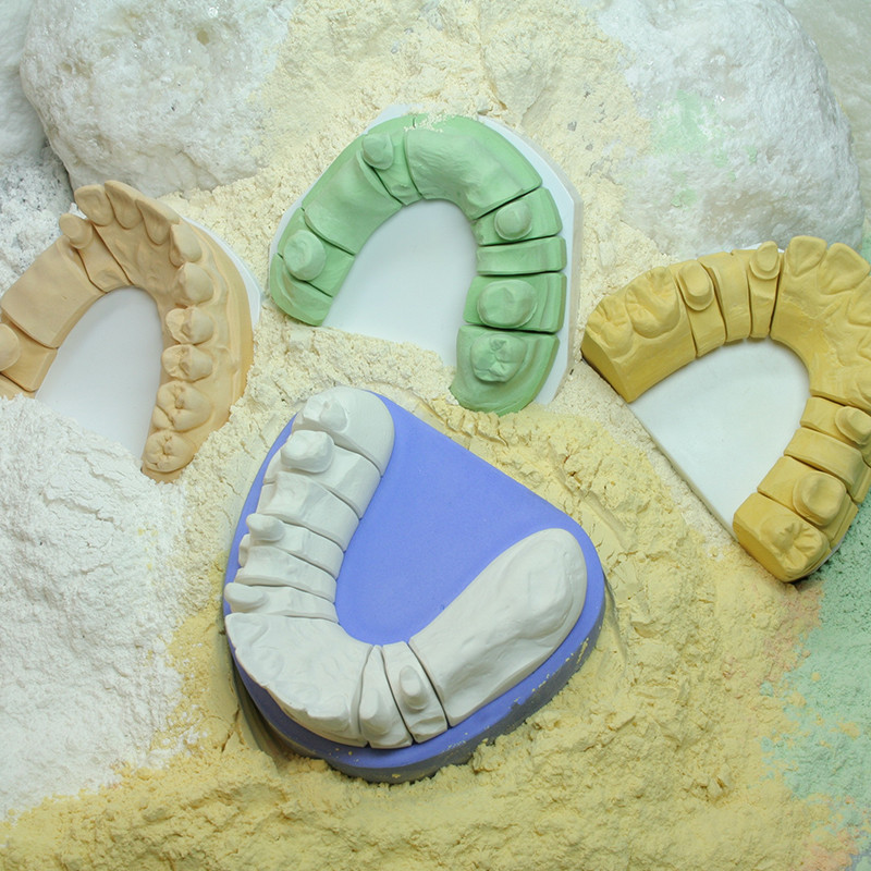 Abbey Dental Supplies - Marmorock 20 Golden Brown (25kg Carton) Die ...